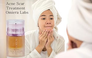 Acne Scar Treatment Home Omiera Labs